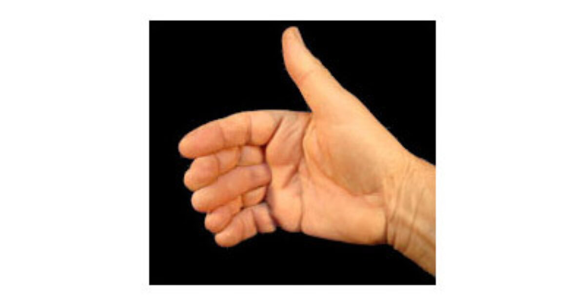 my-magicshop.com | Sixth Finger Vernet (normal)